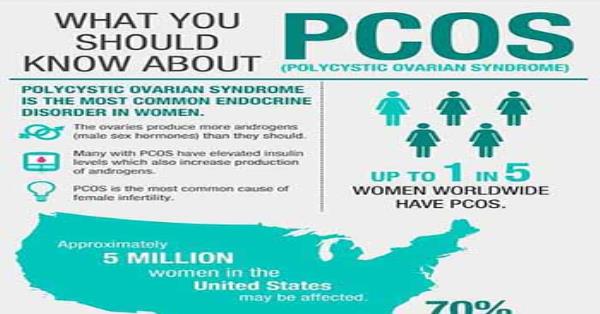 Infographic on What You Should Know About Polycystic Ovary Syndrome (PCOS) Infographics ...