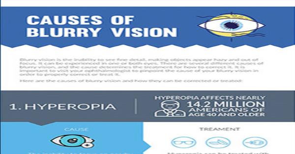 Causes of Blurry Vision Infographic Infographics | Medicpresents.com