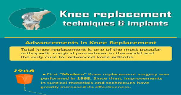 Knee Replacement Techniques and Implants Infographic Infographics ...