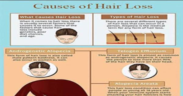 Causes of Hair Loss Infographic Infographics | Medicpresents.com