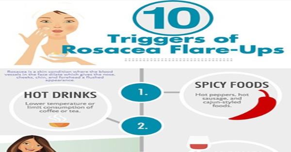 10 Triggers of Rosacea Flare-Ups Infographic Infographics ...