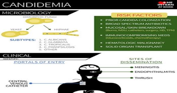 Candidemia Infographic Infographics | Medicpresents.com