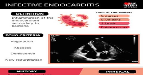 Infective Endocarditis Infographic Infographics | Medicpresents.com