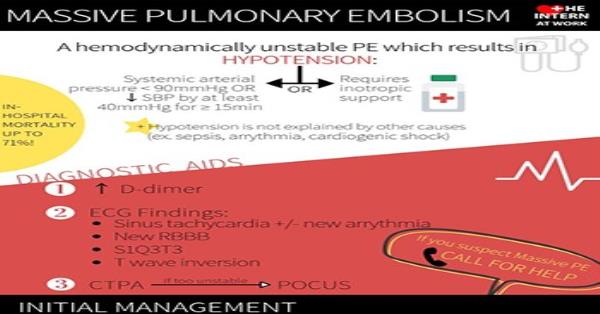 Massive Pulmonary Embolism Infographic Infographics | Medicpresents.com