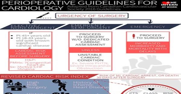 Perioperative Guidelines For Cardiology Infographic Infographics ...