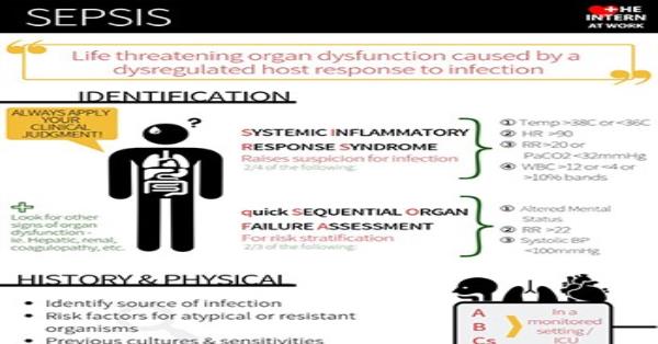 Sepsis Infographic Infographics | Medicpresents.com