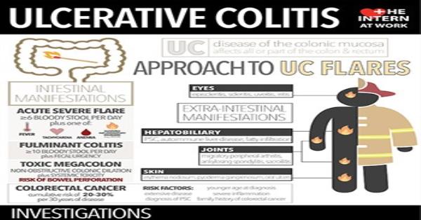 Ulcerative Colitis Infographic Infographics | Medicpresents.com