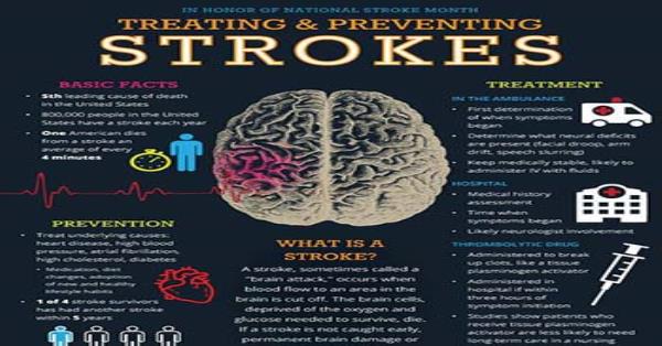 Treating & Preventing Strokes Infographic Infographics | Medicpresents.com