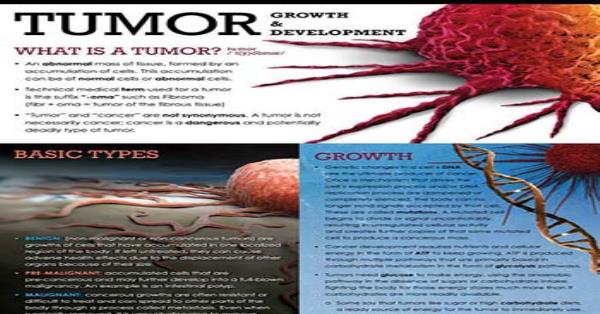 Tumor Growth & Development Infographic Infographics | Medicpresents.com