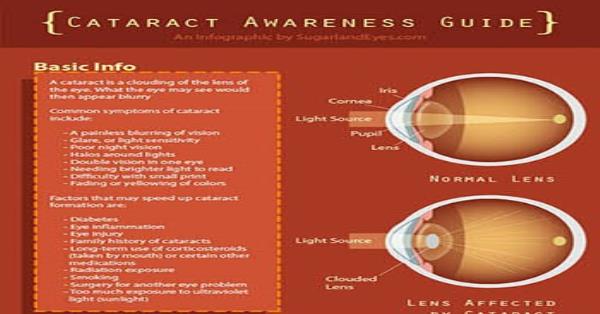 Cataracts Awareness Guide Infographic Infographics | Medicpresents.com