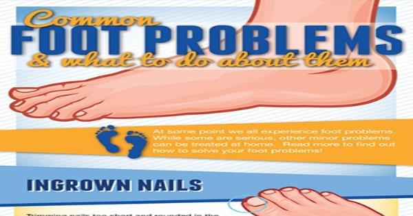 Common Foot Problems Infographic Infographics | Medicpresents.com