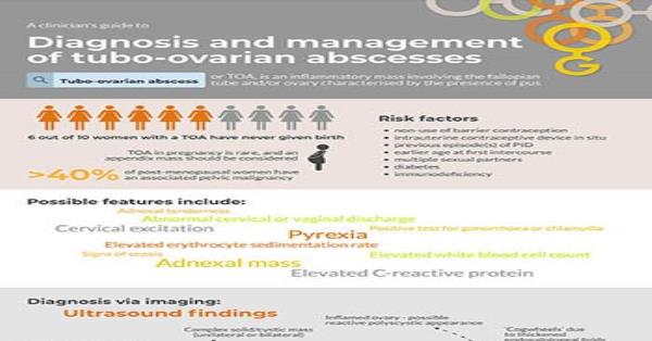 Diagnosis And Management Of Tubo Ovarian Abscesses Infographic