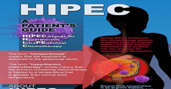 HIPEC - A Patient’s Guide Infographic Infographics | Medicpresents.com