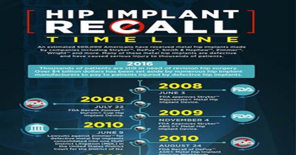 Hip Implant Recall Timeline Infographic Infographics | Medicpresents.com