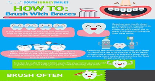 How To Brush With Braces Infographic Infographics | Medicpresents.com