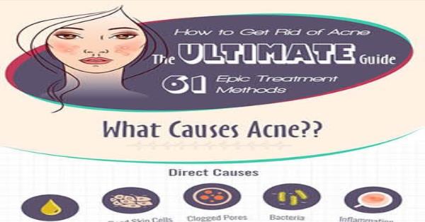 How to Get Rid of Acne Infographic Infographics | Medicpresents.com