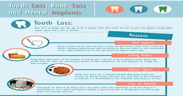 Tooth Loss, Bone Loss and Dental Implants Infographic Infographics ...