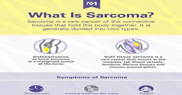 What Is Sarcoma Infographic Infographics | Medicpresents.com