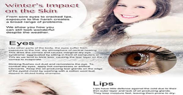 Winter’s Impact on the Skin Infographic