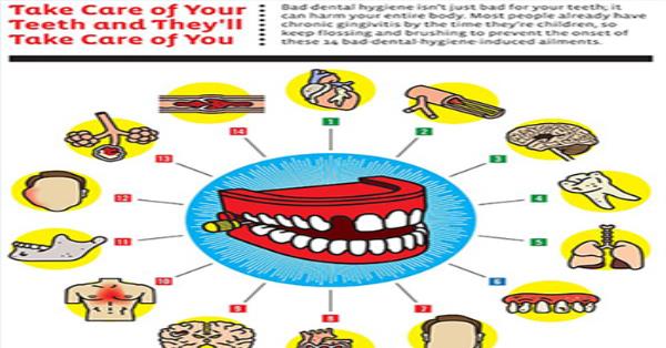 Take Care of Your Teeth and They Will Take Care of You Infographic ...