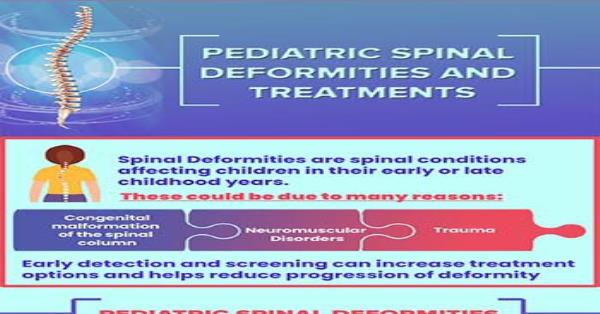 Pediatric Spinal Deformities and Treatments Infographic Infographics ...