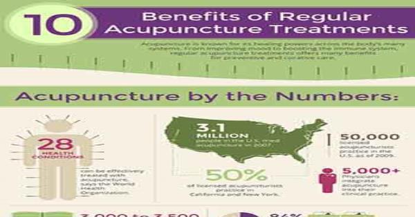 10 Benefits of Regular Acupuncture Treatments Infographic Infographics | Medicpresents.com