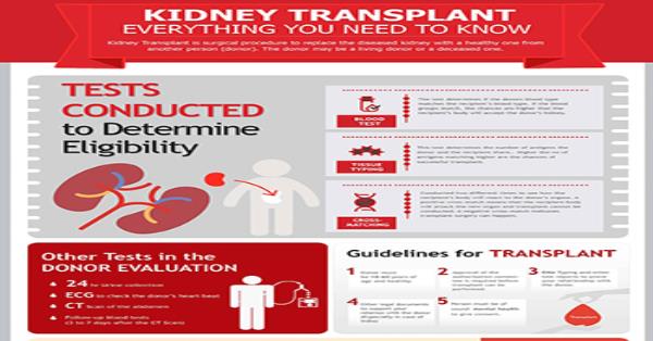 Kidney Transplant - Everything You Need to Know Infographic ...