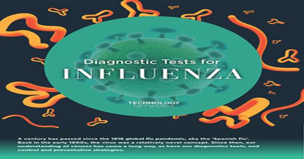 Diagnostic Tests for Influenza Infographic Infographics | Medicpresents.com