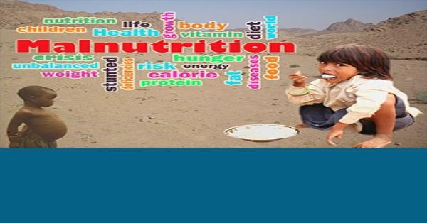 Malnutrition Infographics | Medicpresents.com