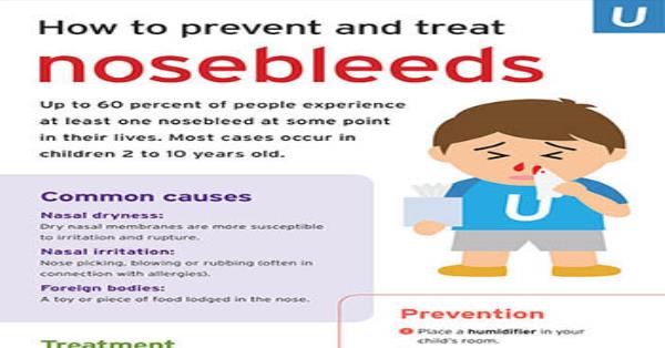 Health Tips for Parents – How to prevent and treat nosebleeds ...