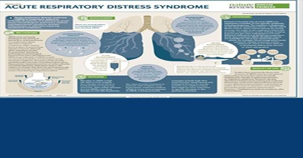 Acute Respiratory Distress Syndrome Infographics | Medicpresents.com