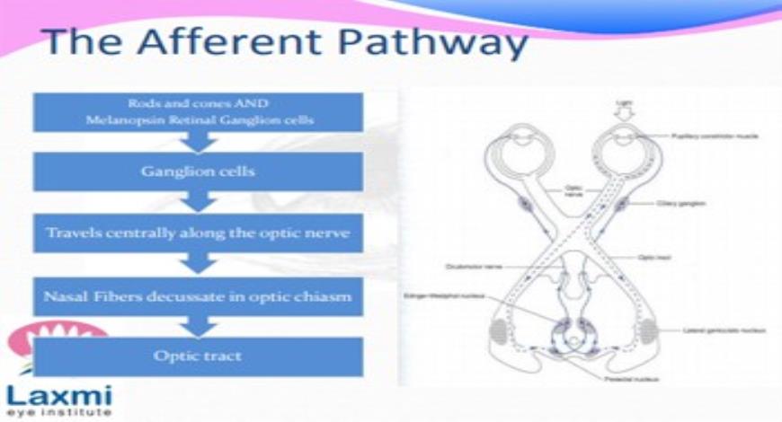 Download Medical Notes on The Pupillary Pathway