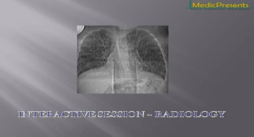 Download Free Medical INTERACTIVE SESSION - RADIOLOGY PowerPoint ...