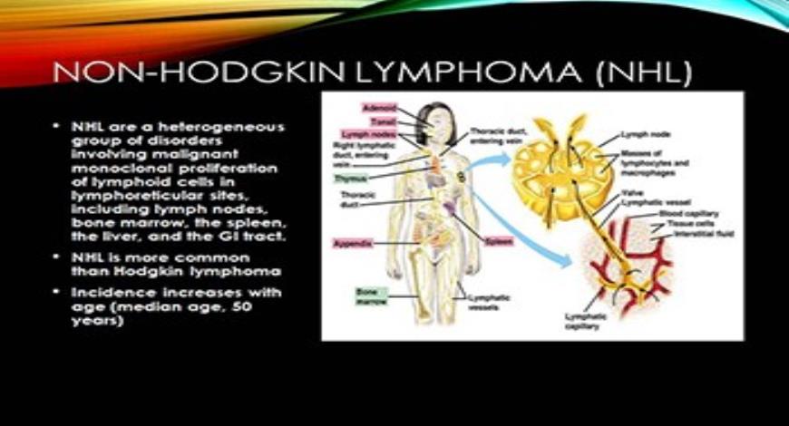 Download Free Medical NON-HODGKIN LYMPHOMA (NHL) PowerPoint Presentation