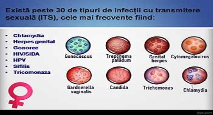 Download Free Medical Sexually Transmitted Infections PowerPoint ...