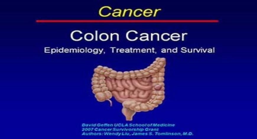 Download Free Medical Colon Cancer - Epidemiology Treatment and ...