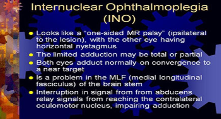 Download Free Medical A and V Patterns and Other Types of Strabismus ...