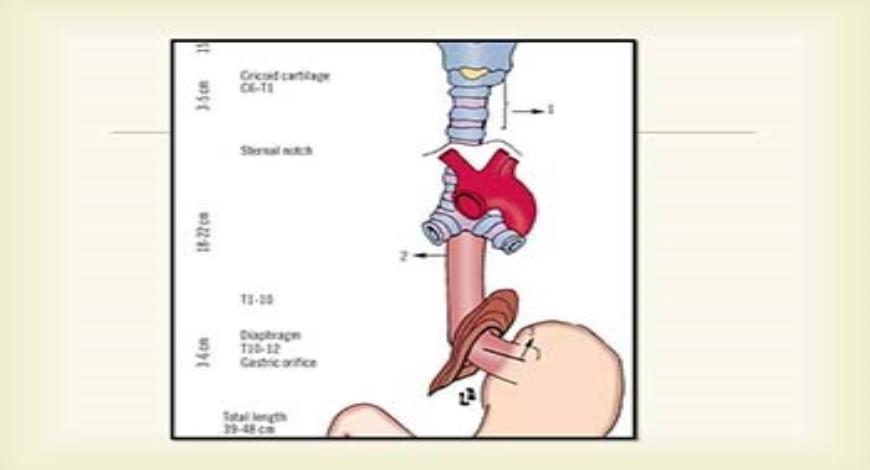 Download Free Medical Esophagus: Anatomy Physiology Corrosive stricture ...