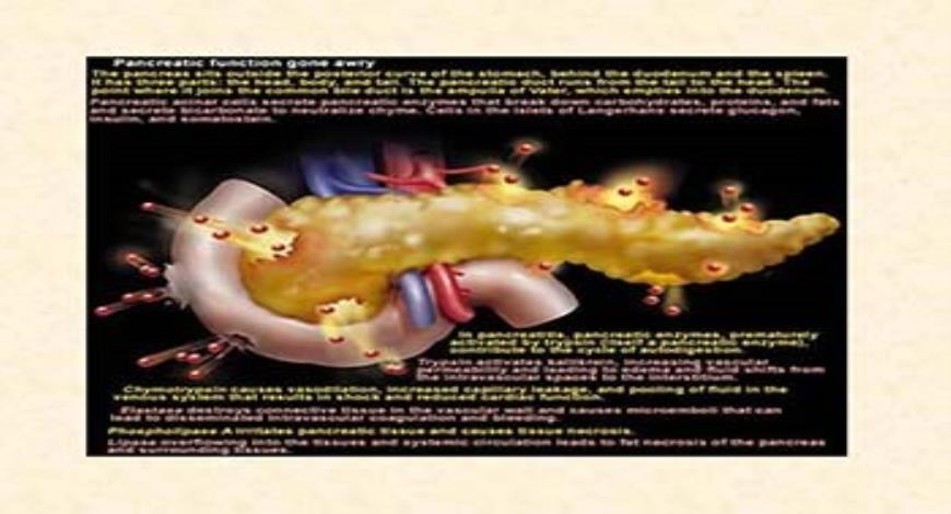 Download Free Medical Acute Pancreatitis PowerPoint Presentation