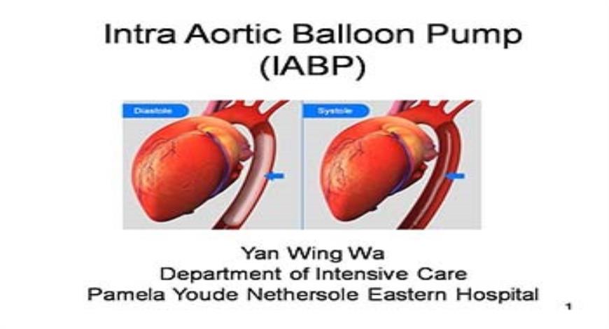 Download Free Medical Intra Aortic Balloon Pump (IABP) PowerPoint ...