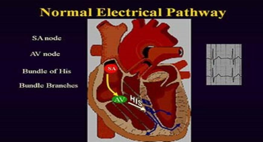 Download Free Medical Advanced EKG Interpretation PowerPoint Presentation