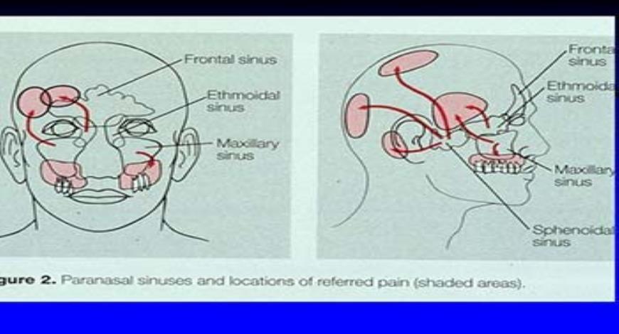 Download Free Medical Acute Sinusitis - Diagnosis Management and ...