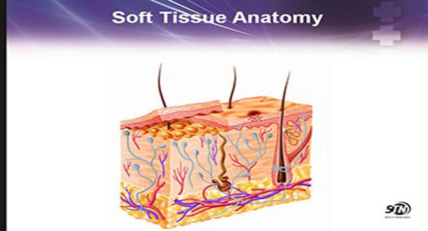 Download Free Medical Soft Tissue Injuries PowerPoint Presentation