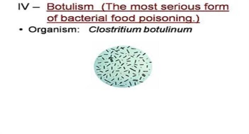 Download Free Medical Food Poisoning Wiki PowerPoint Presentation