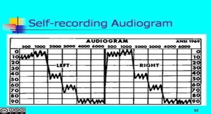 Download Free Medical The Audiogram PowerPoint Presentation