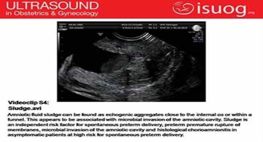 Download Free Medical How to measure cervical length PowerPoint ...