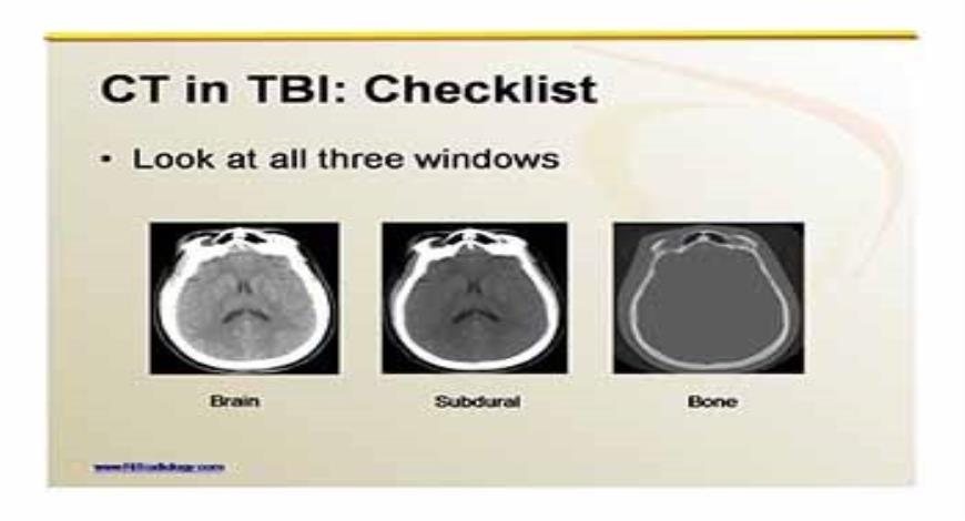 Download Free Medical Imaging of Traumatic Brain Injury PowerPoint ...