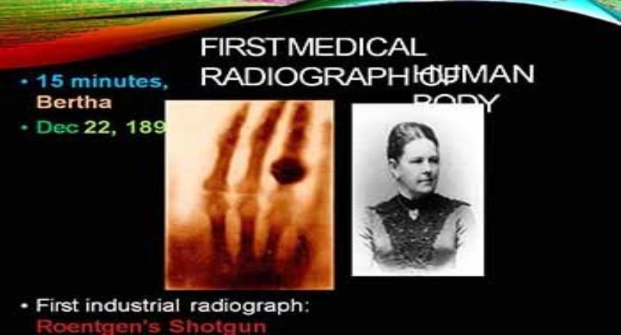 Download Free Medical HISTORY OF RADIOLOGY PowerPoint Presentation