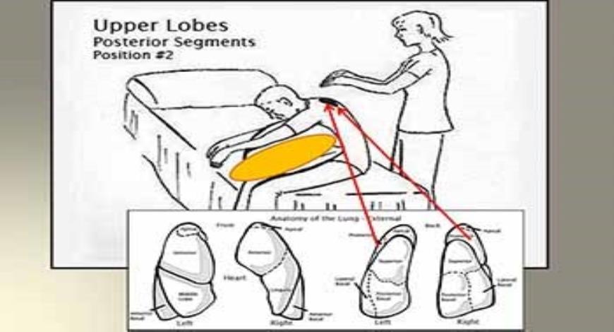 Download Free Medical CHEST PHYSIOTHERAPY PowerPoint Presentation