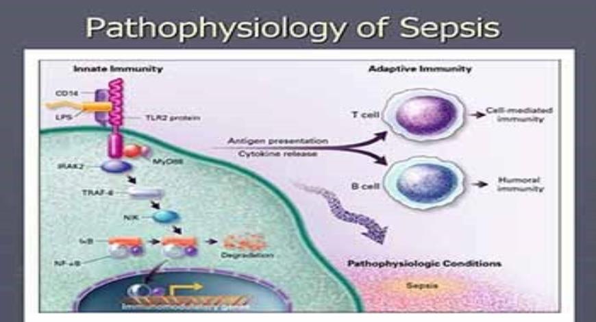 Ppt Sepsis Pathophysiology And Treatment Powerpoint PPT SEPTIC SHOCK